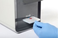 Haematology | Full Blood Count FBC Analyser